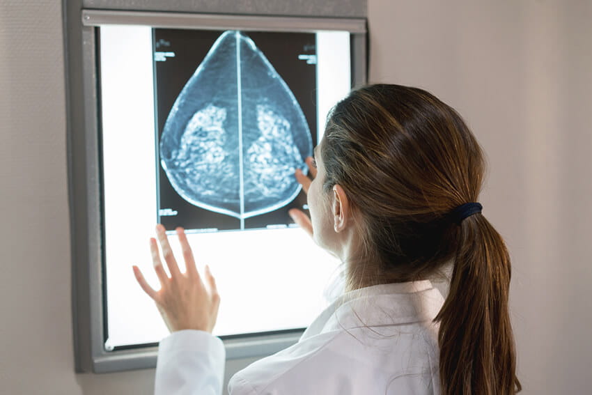 Blog – Breast cancer radiotherapy: What is prone breast radiation ...